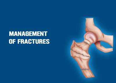 Management of Fractures - Explained by Orthopedic Surgeon
