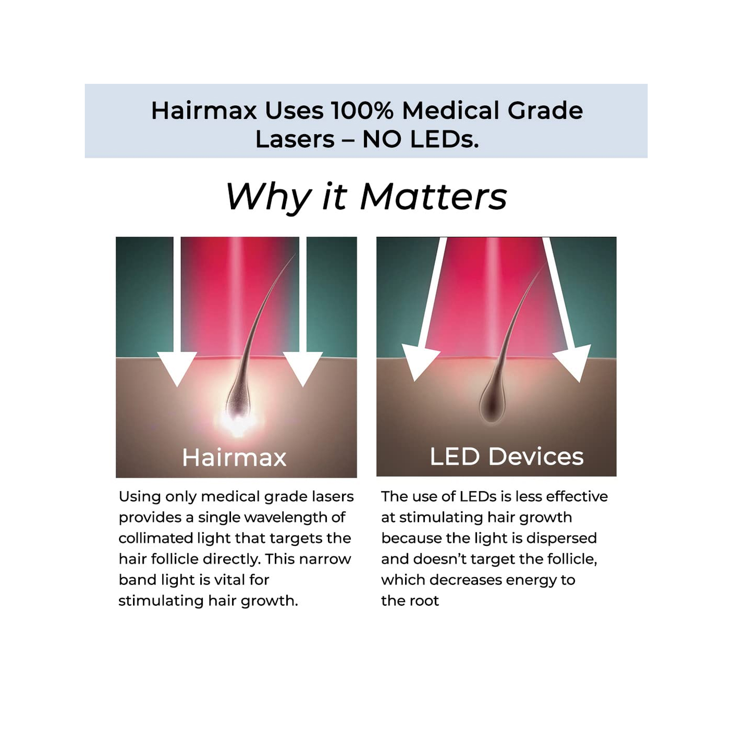 HairMax Hair Growth Laser Light Device For Men and Women buy online at ...