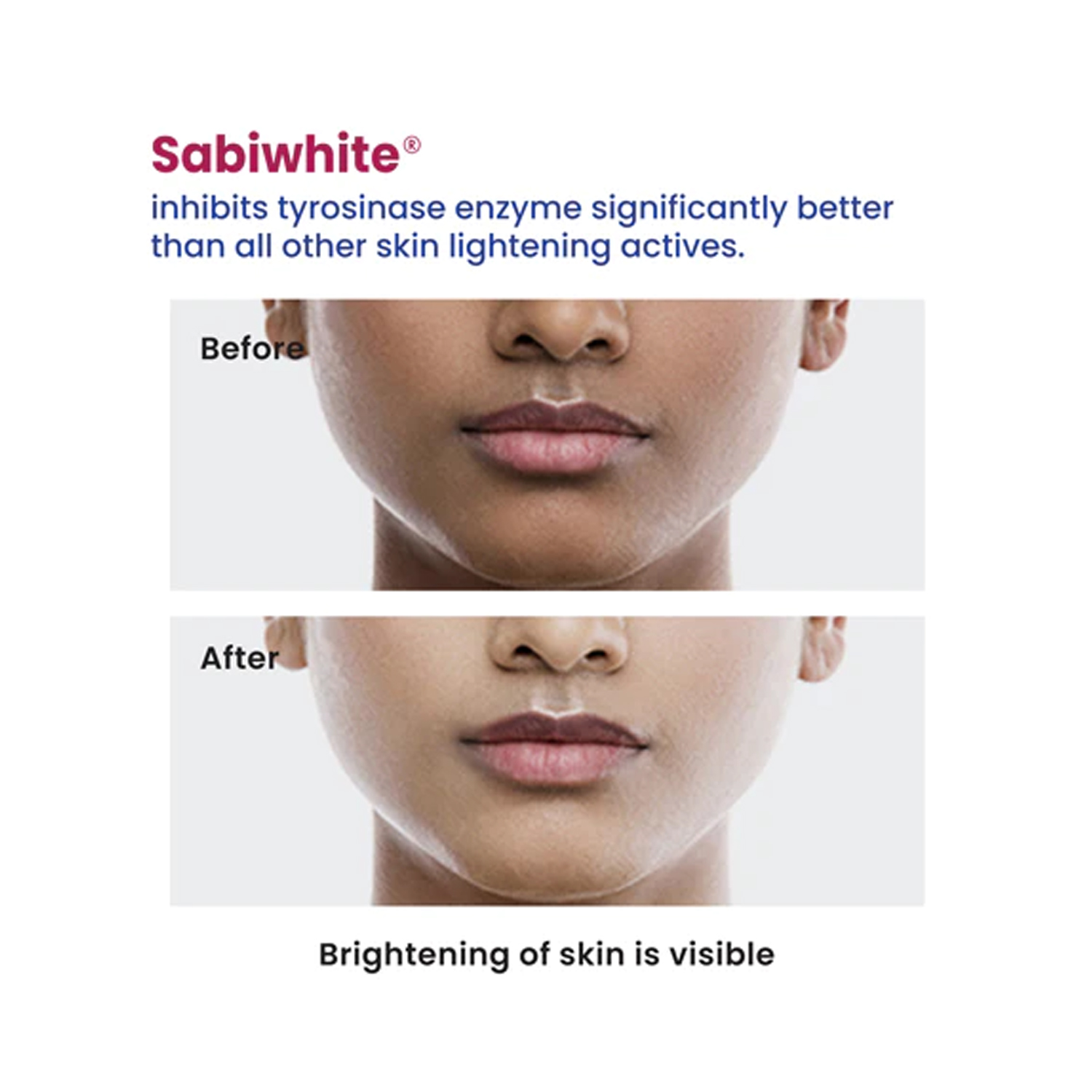 Derma Essentia Skin Brightening Cream For Pigmentation & Dark Spots 30g ...