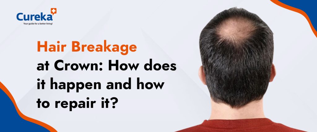 Hair Breakage at Crown: How Does it Happen and How to Repair it