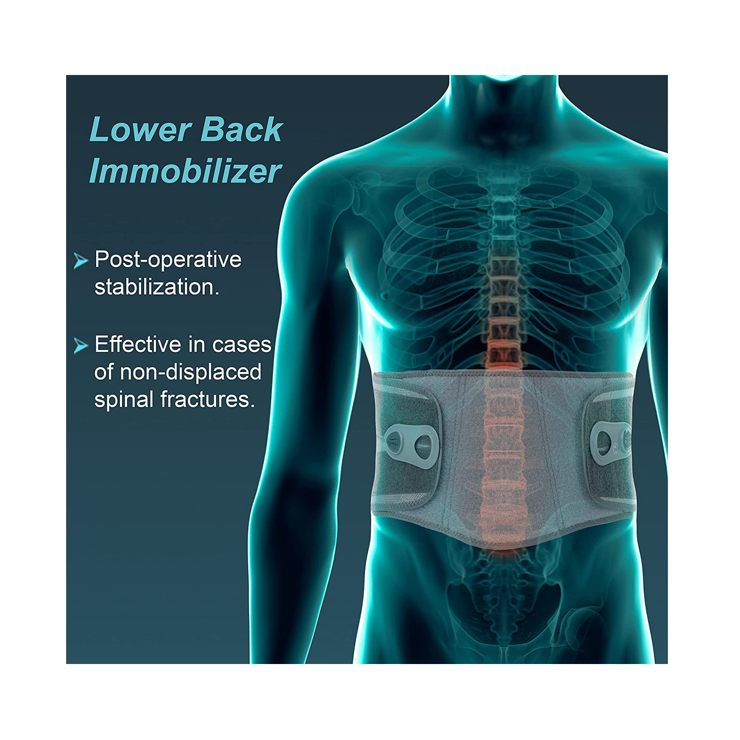 Tynor Lumbo Lacepull Brace - Universal A-29 - Cureka - Online Health ...