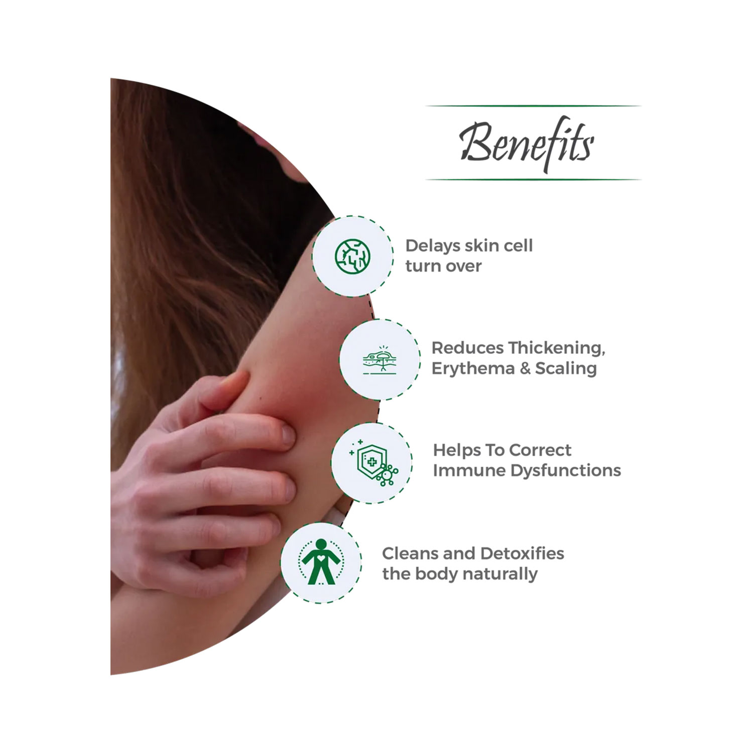 Vital Care Bactimo Capsule for Psoriasis (10x10 Capsules) - Cureka ...