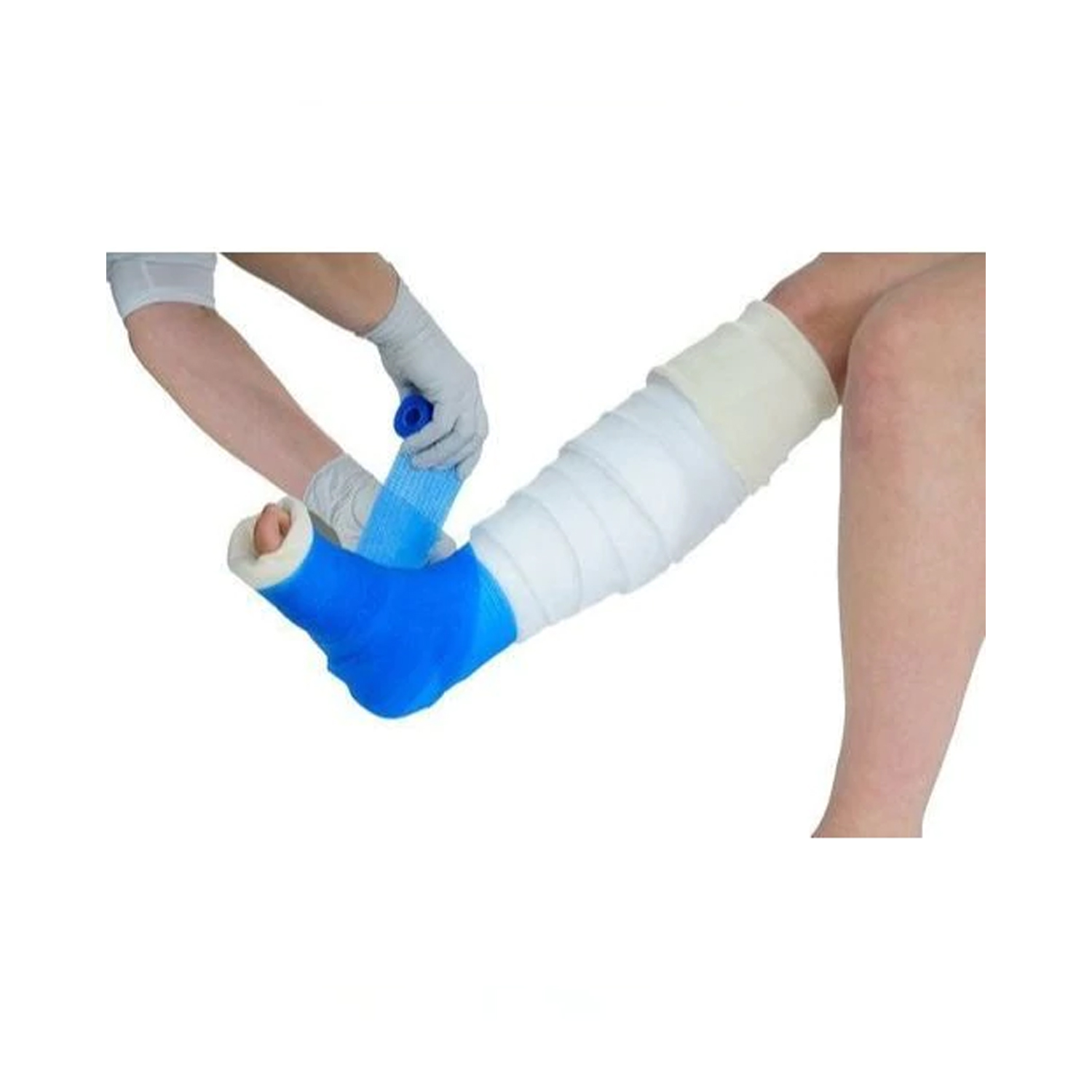 Vissco - Active Cast - Orthopaedic Fiberglass Casting Tape (Blue) - (PC ...